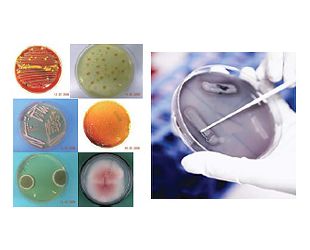 AXIMA Microorganism Identification System : Shimadzu SOPS